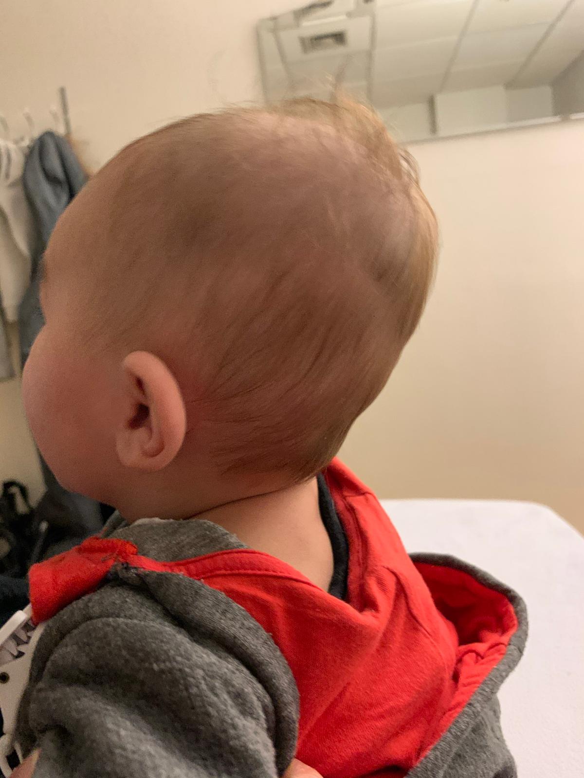 Crâne plat – Sarah ISRAEL Ostéopathe DO